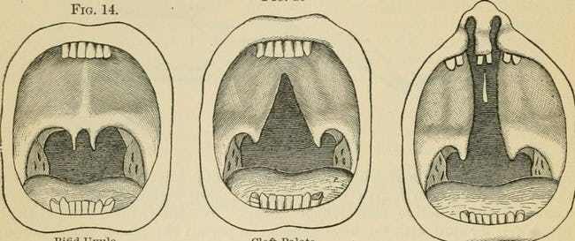 The Story Of The Man Who Died From Drinking Too Much Radium | timalderman