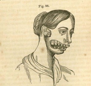 The Story Of The Man Who Died From Drinking Too Much Radium | timalderman